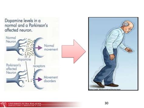 Neurocognitive Disorder Ncd Ppt