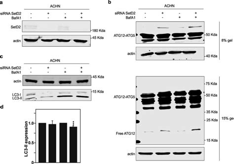 Setd2 Mutation In Renal Clear Cell Carcinoma Suppress Autophagy Via Regulation Of Atg12 Pmc