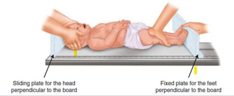 Pas 251b Growth In Pediatrics Flashcards Quizlet