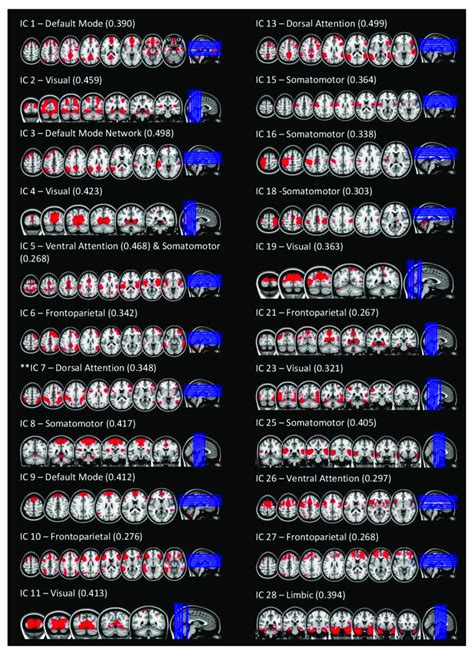 Results For Group Ica Independent Components Ic Were Labeled And