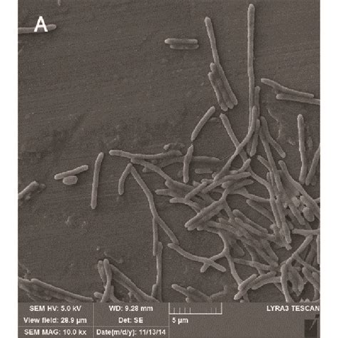 Scanning Electron Micrographs Of Brevibacillus Borstelensis Strain Ak1 Download Scientific