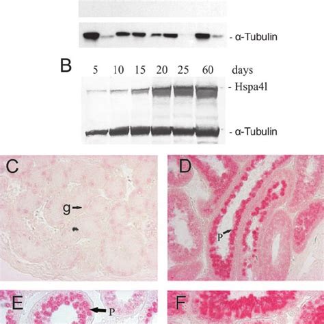 Expression Profile And Cellular Localization Of Hspa4l During Testis