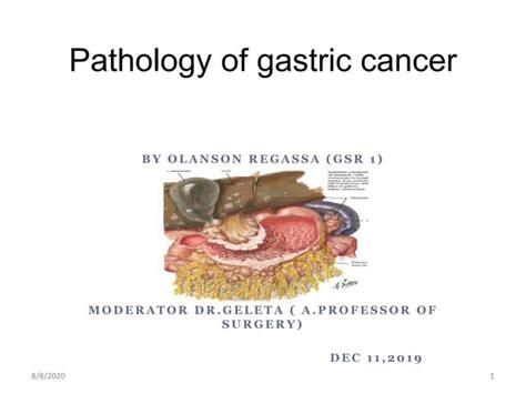 Epathology Of Gastric Cancer Pptx