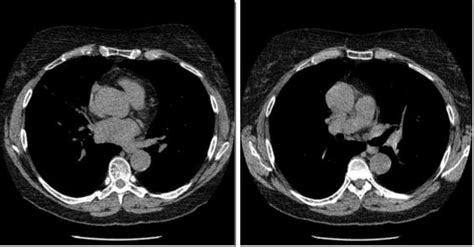 Figure 2 From Detection Of Deepfake Medical Images Based On Spatial And Frequency Domain