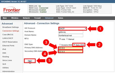 Frontier Router Lights All Colors Easy Fixes The Flexible Worker
