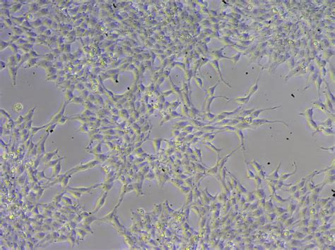 Recombinant Human Fgf Basicfgf2bfgf 146 Aa Protein 233 Fb 025 Randd Systems