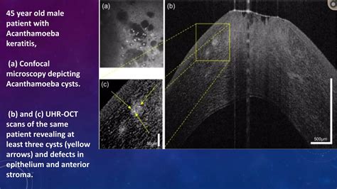 Anterior Segment And Corneal Oct Review Ppsx