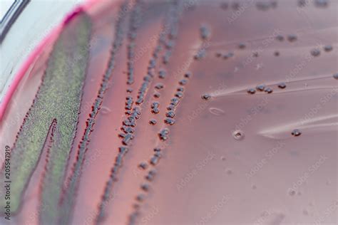 Colony Characteristics Of Escherichia Coli E Coli Is A Gram Negative Facultatively Anaerobic