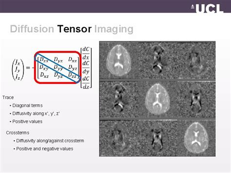 Diffusion Tensor Imaging Overview Theory Basic Physics Tensor