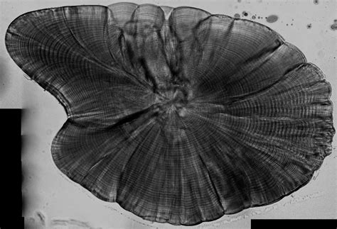 Otolith Microstructure Analysis Hatfield Marine Science Center