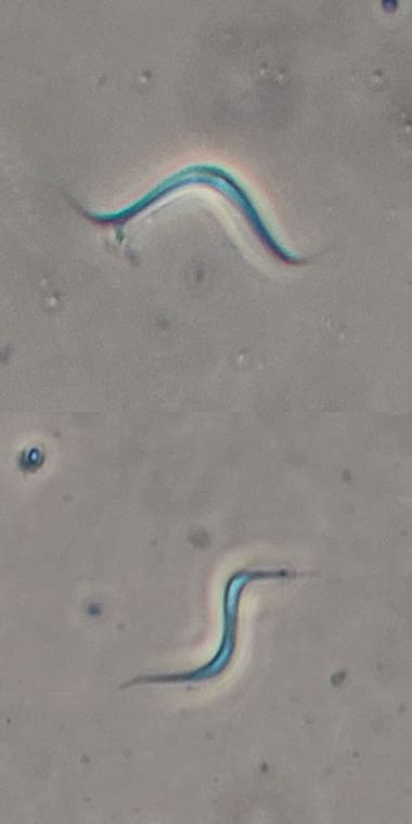 Monoraphidium Contortum In July 2024 By Alex Kenins · Inaturalist Monoraphidium Contortum In July 2024 By Alex Kenins · Inaturalist