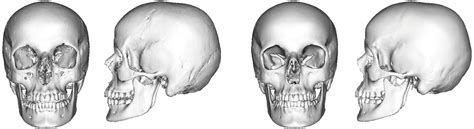 A Method For Automatic Forensic Facial Reconstruction Based On Dense Statistics Of Soft Tissue