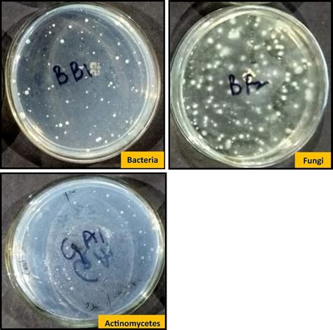 Colonies Of Bacteria Fungi And Actinomycetes Download Scientific Diagram