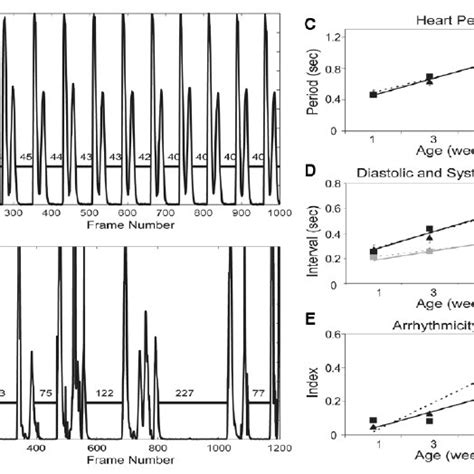 Heart Beat Intervals And Quantification Of Arrhythmicity Download