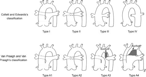 Truncus Arteriosus Types