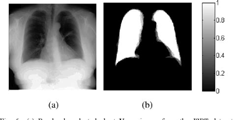 Figure 1 From Lung Segmentation In Chest Radiographs Using Anatomical