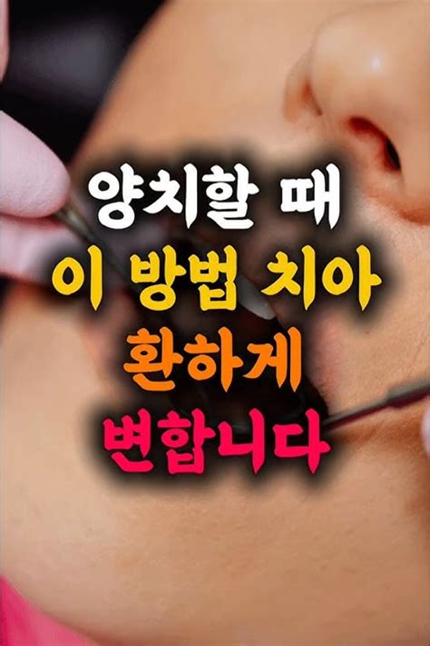 양치할 때 이 방법 치아가 환하게 변합니다 치아관리 양치습관 구강건강 생활꿀팁 하얀치아 Youtube