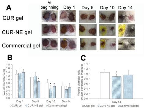 Development And Characterization Of A Hydrogel Containing Curcumin Loaded Nanoemulsion For