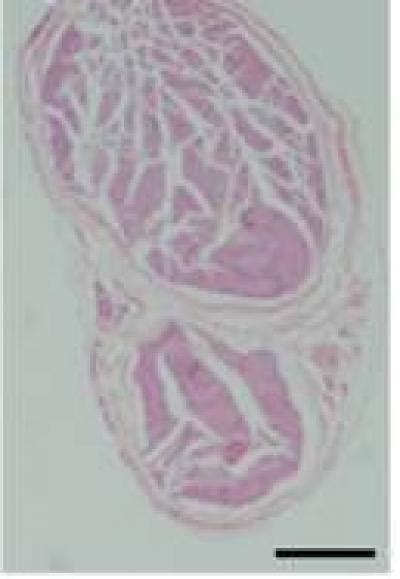 The Optimal Mitomycin C Concentration For Intact Peripheral Nerve Structure And Function