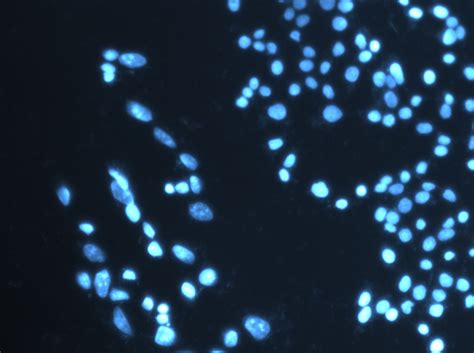 Mycoplasma Test With Hoechts 33342 Can Anyone Please Comment On My