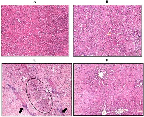 Representative Image Of Hepatic Sections Stained With H E A Control Download Scientific