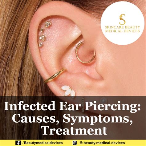 Signs Of A Ear Piercing Infection Qgiuxa
