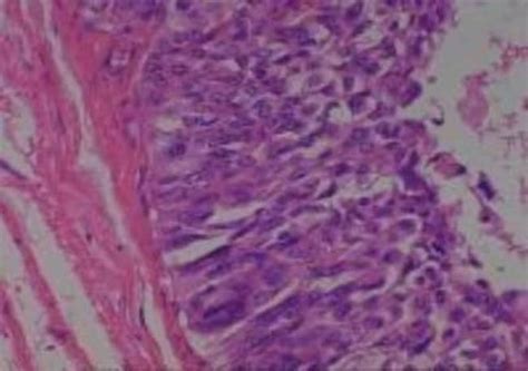 Novus Biologicals Human Multi Tissue Microarray Normal Adjacent