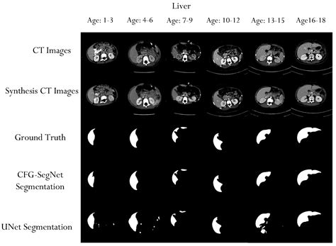 Age Encoded Adversarial Learning For Pediatric Ct Segmentation