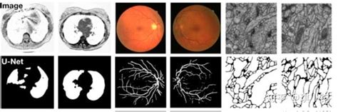 U Net ：convolutional Networks For Biomedical Image Segmentation 论文详解 知乎