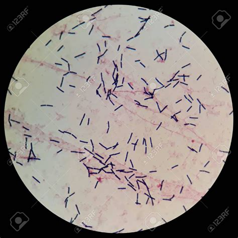 Solved Estimate The Cell Size In Micrometers In The Chegg