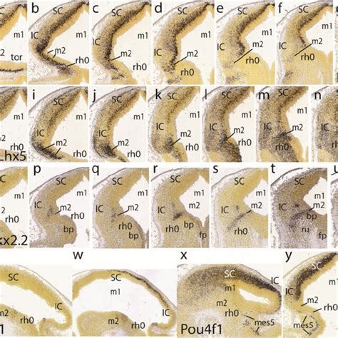 Plate Illustrating Diverse E15 5 Mouse Brain Sagittal A D U Bb Or Download Scientific Diagram