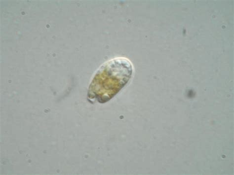 Amphidinium Alchetron The Free Social Encyclopedia