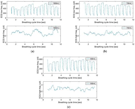 A Wearable Multimodal Wireless Sensing System For Respiratory Monitoring And Analysis