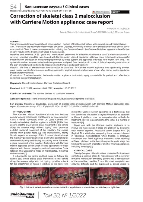 Pdf Correction Of Skeletal Class 2 Malocclusion With Carriere Motion Appliance Case Report