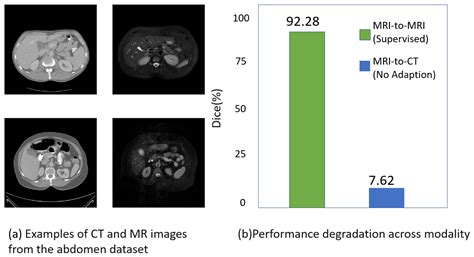 Cross Modality Medical Image Segmentation Via Enhanced Feature Alignment And Cross Pseudo