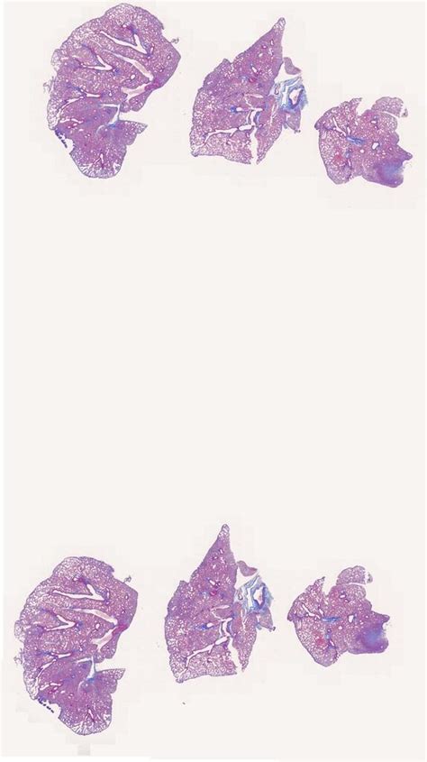 Qupath Image Upload Issues Usage And Issues Imagesc Forum