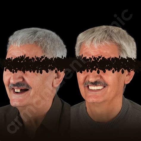 گالری تصاویر ایمپلنت کلینیک دندانپزشکی آرمانی در شهریار