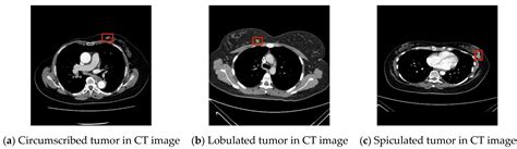 Jcm Free Full Text Complete Fully Automatic Detection And Classification Of Benign And