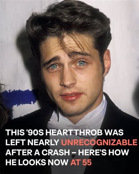 This ‘90s Heartthrobs Face Was Smashed In By His Ex — And What He Said