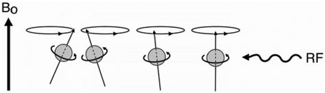Radio Frequency Pulse Radiology Key
