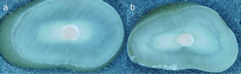 Inspection Of The Apical A And Coronal B Aspects Of The Slices