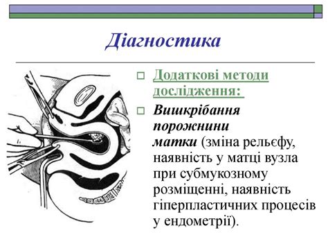 Доброякісні пухлини жіночих статевих органів Лекція №9 презентация онлайн