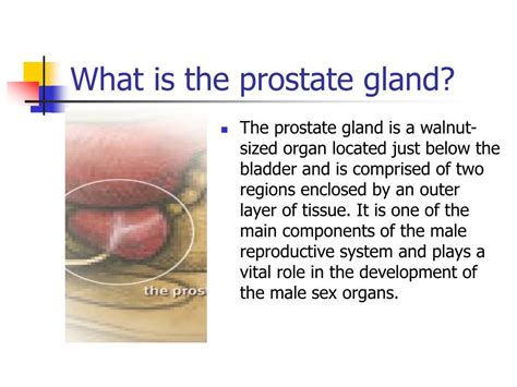 Ppt The Prostate Gland Prostate Cancer And Brachytherapy Powerpoint Presentation Id484852