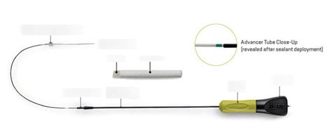 Mynx Diagram Quizlet