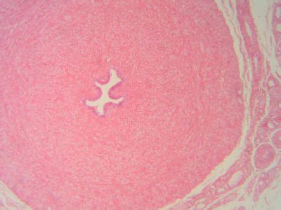 Vas Deferens Histology Vas Deferens Histology Slide