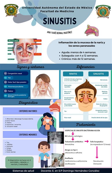 Sinusitis Sistemas De Salud Inflamación De La Mucosa De La Nariz Y