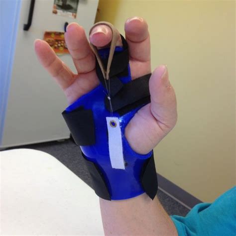 Splints On Pinterest Hand Therapy Hand Surgery Trigger Finger Exercises