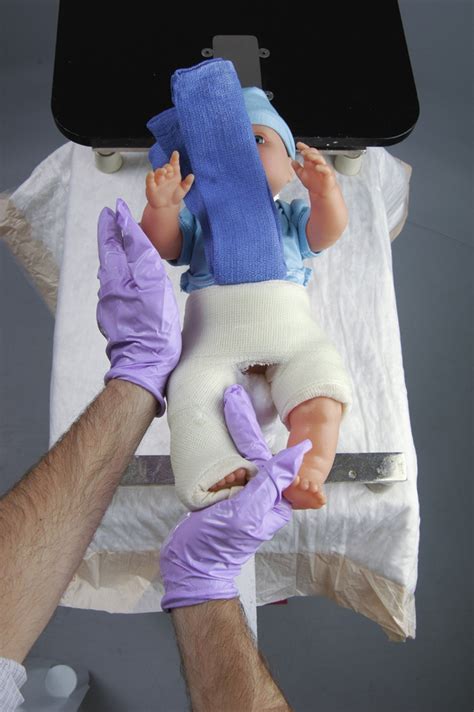Lower Extremity Splints And Casts Musculoskeletal Key