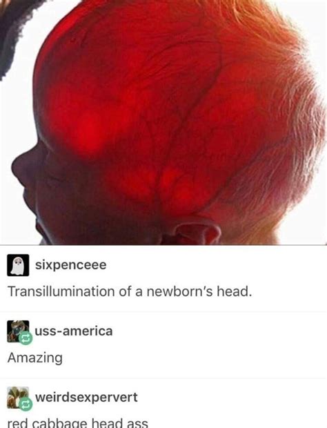 Best Red Heads Images On Pholder Birding Sfw Redheads And Nature Is Fucking Lit