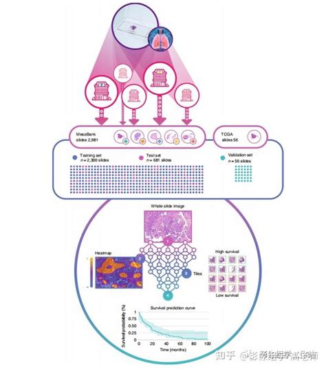 影像组学数据委托实验服务：基于深度学习的间皮瘤分类提高患者预后预测 知乎